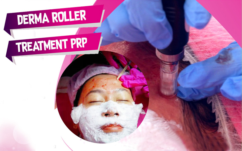 Derma PRP – Glafidsya Medika